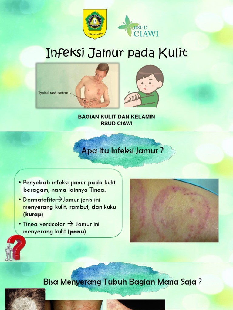 Penyebab dan Gejala Infeksi Jamur Kulit | PDF