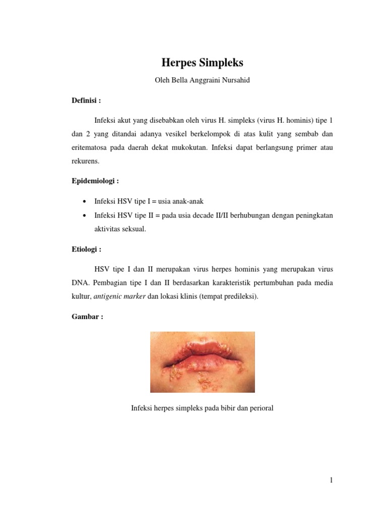 Herpes Simpleks. | PDF
