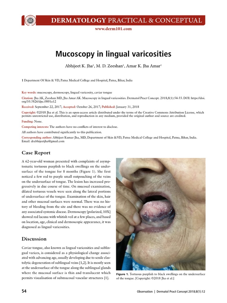 Lingual Varicosities