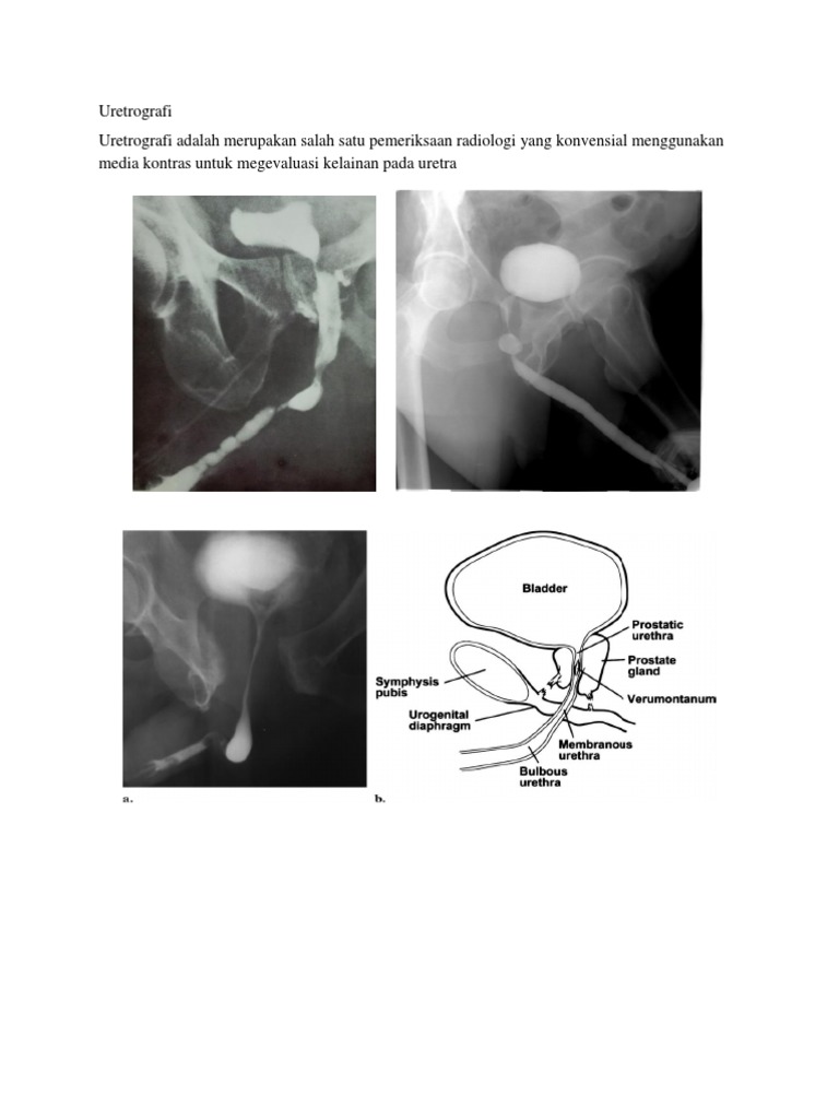 Pemeriksaan Uretrografi | PDF