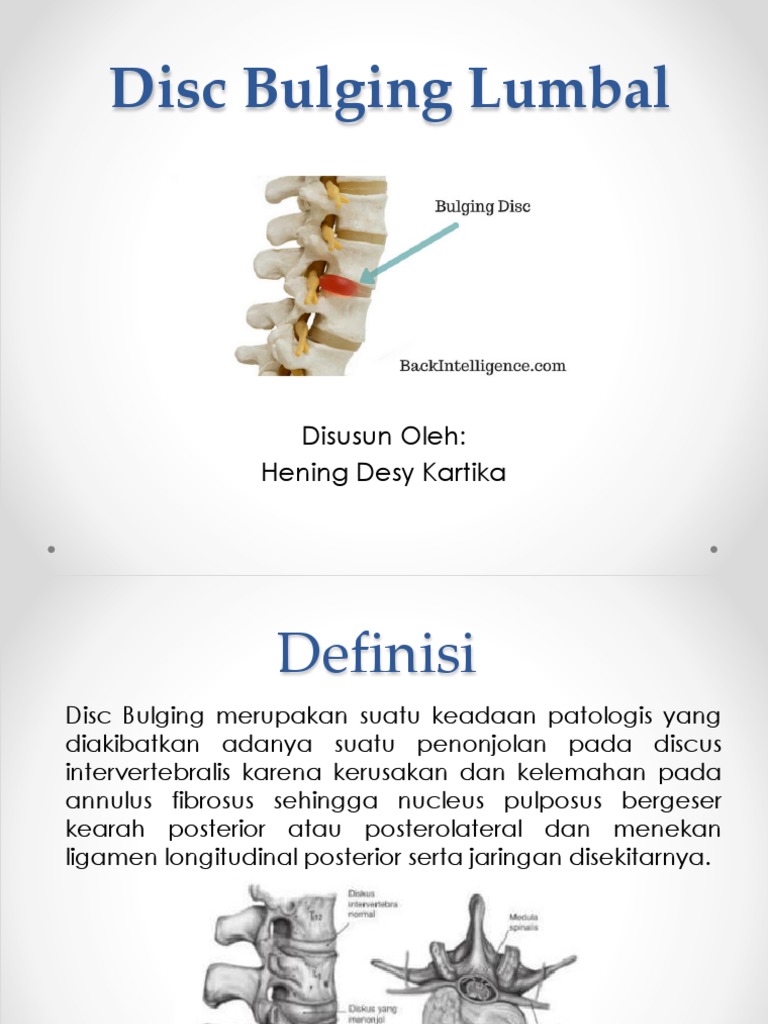 Definisi dan Penanganan Disc Bulging | PDF