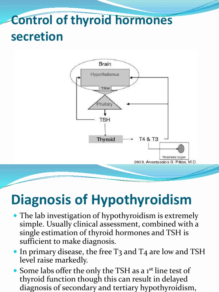 Diagnosis Of Hypothyroidism Download Free Pdf Hypothyroidism