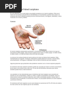 Mano de Predicador: Causas y Tratamiento | PDF | Mano | Enfermedades y ...