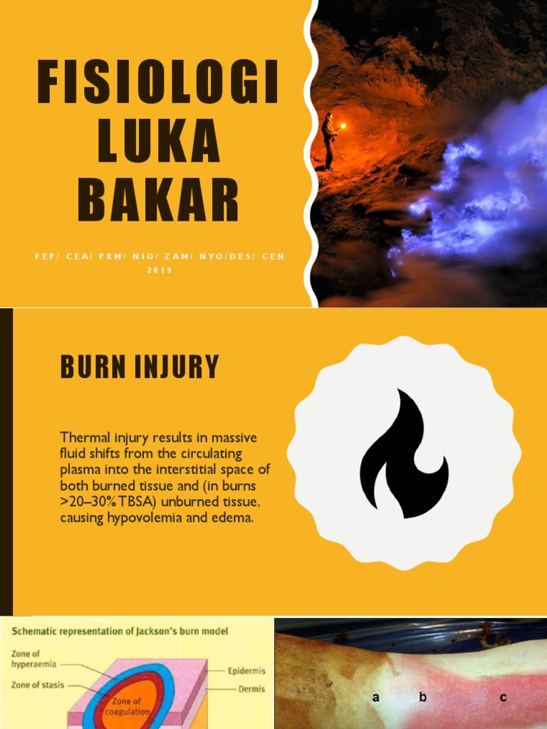Understanding Burn Injury Physiology | PDF | Blood Vessel | Burn