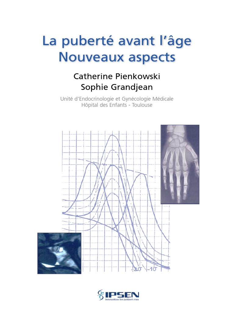 Puberte Precoce PDF | PDF | Leptine | Hypothalamus