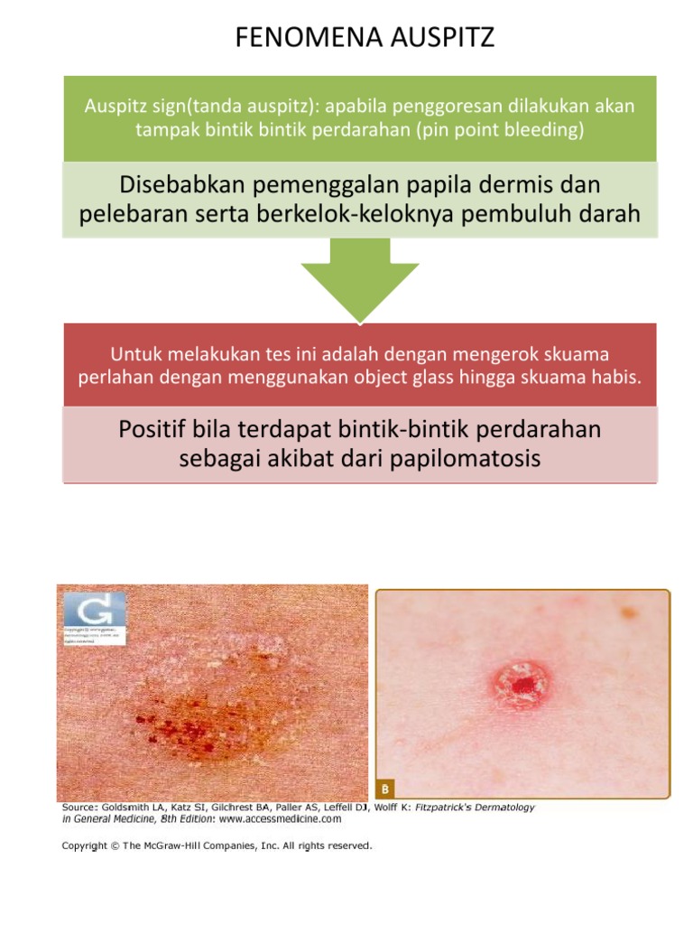 Auspitz | PDF