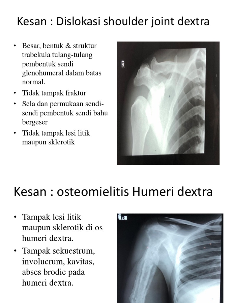 Radiologi Skedel, Vert, Extremitas, Sendi | PDF