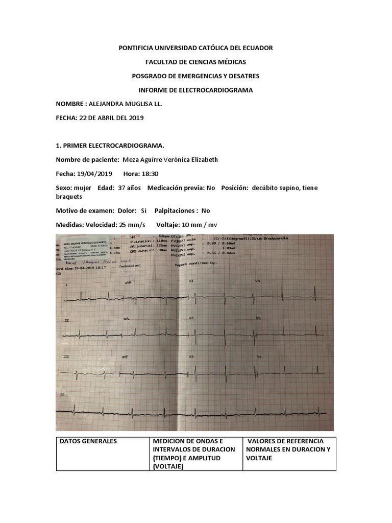 Informe de Electrocardiogramas 2019 | PDF | Electrocardiografia ...