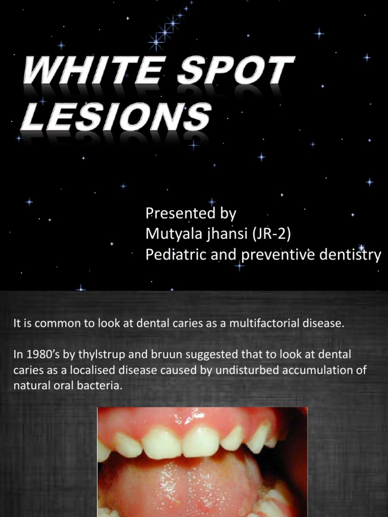 WSL | PDF | Tooth Enamel | Mouth