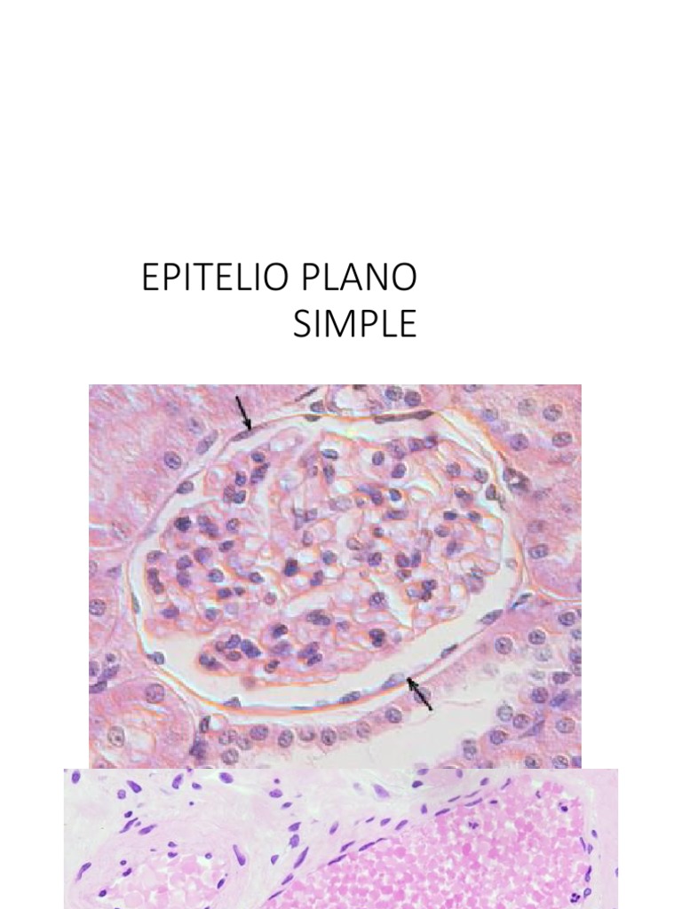 Placas | PDF | Membrana mucosa | Epitelio