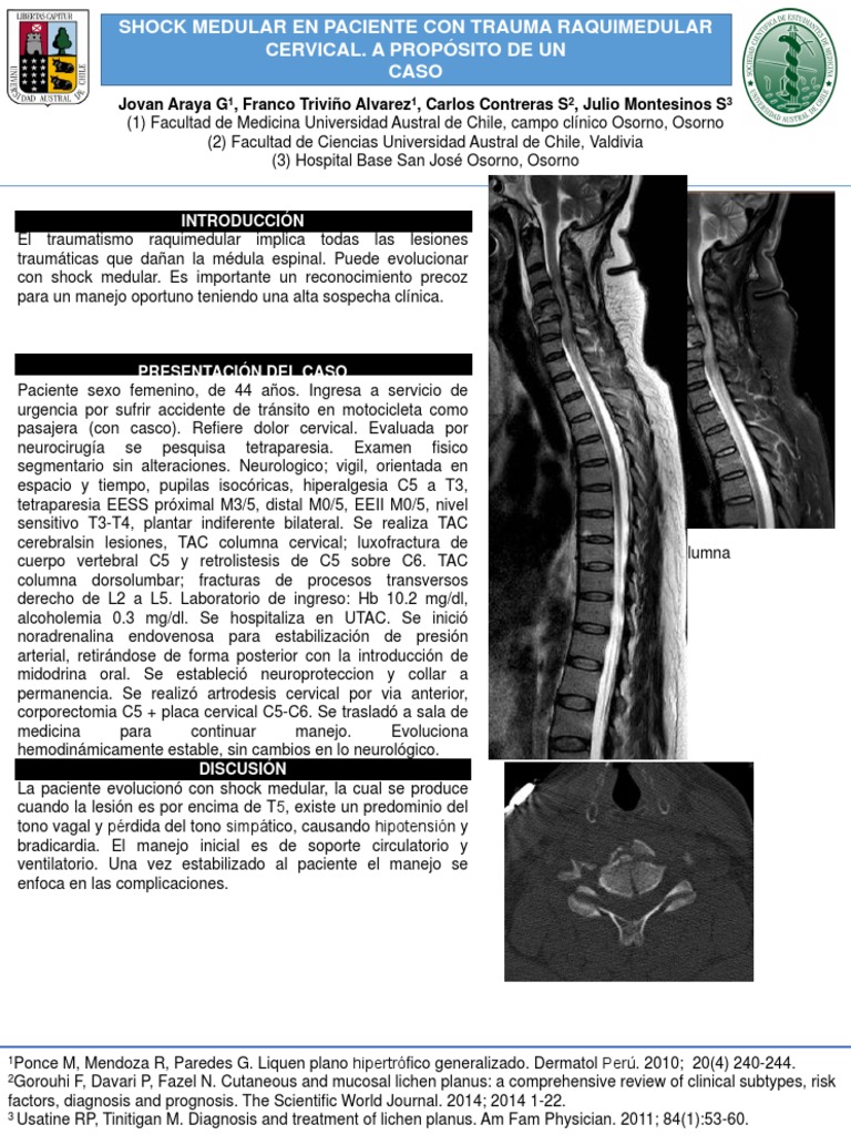 Poster Shock Medular | PDF | Lesión | Enfermedades y trastornos humanos