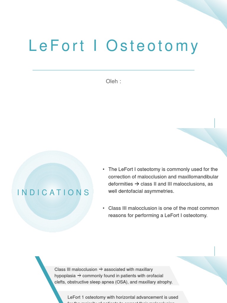 Maxillary Advancement Using LeFort I Osteotomy: Indications, Technique ...