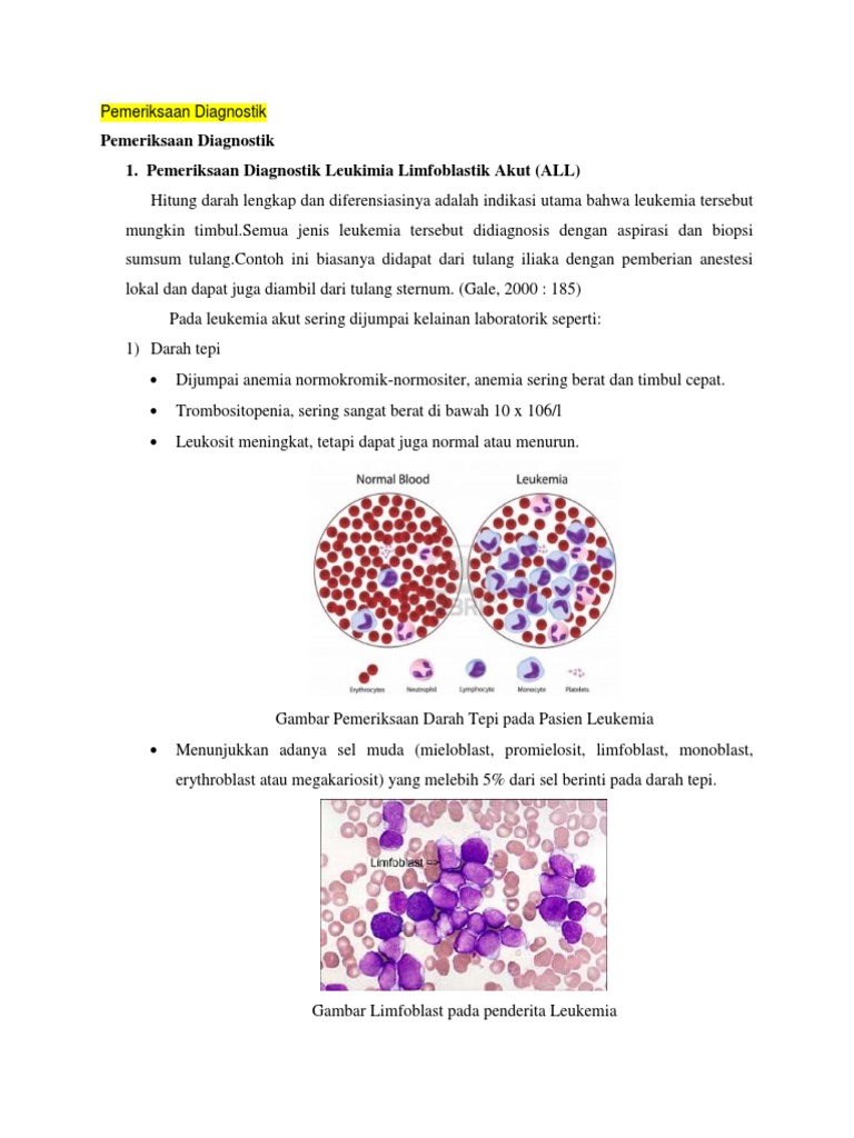 Diagnosa dan Pemeriksaan Leukimia | PDF | Pengembangan Diri | Kesehatan ...