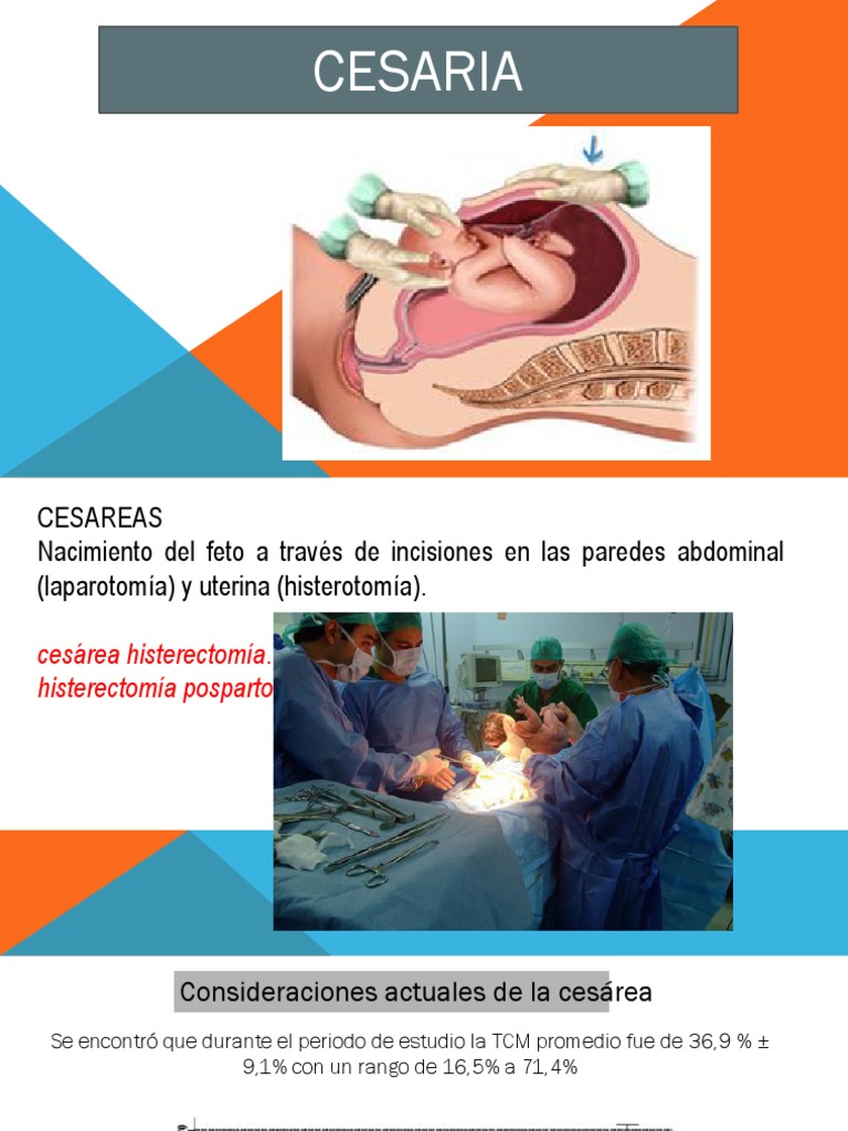 Protocolo y tipos de cesárea | PDF | Seccion de cesárea | Parto