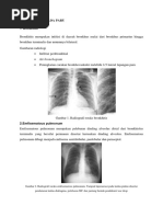 Anatomi Thorax Normal + Gambaran Radiologi | PDF