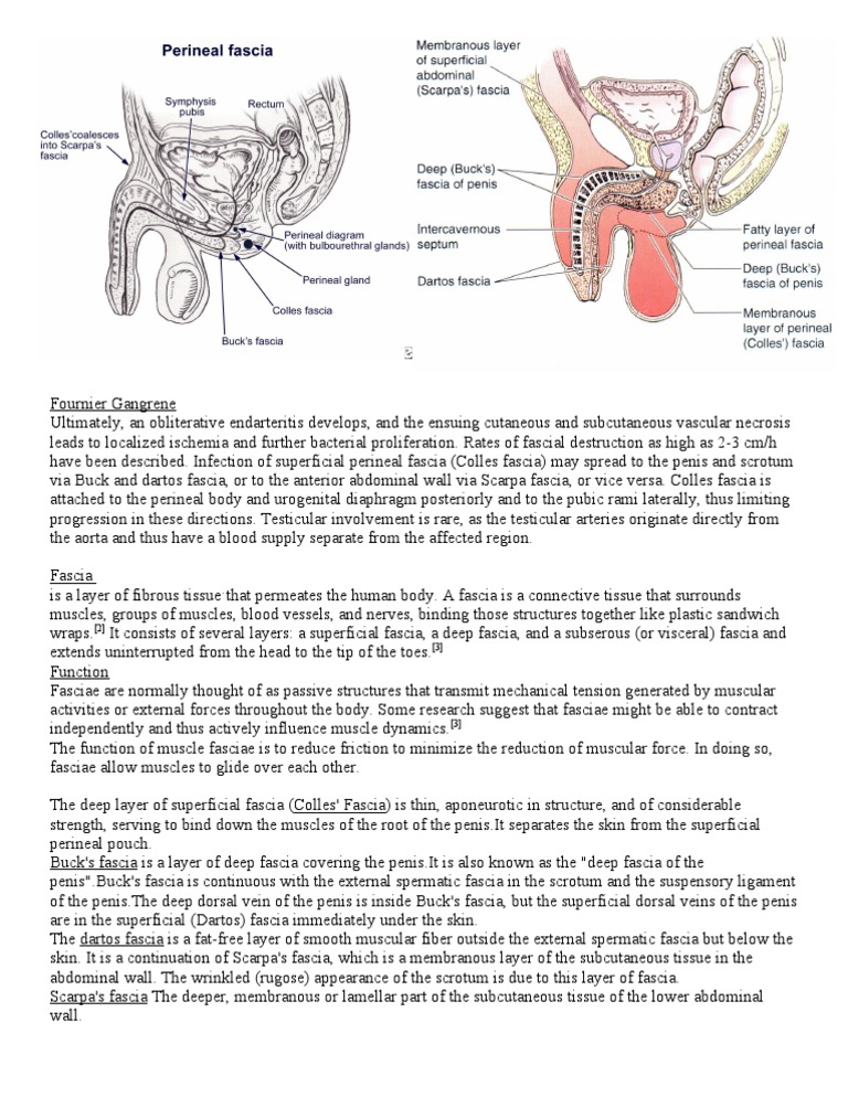 Fournier Gangrene | PDF | Soft Tissue | Tissue (Biology)