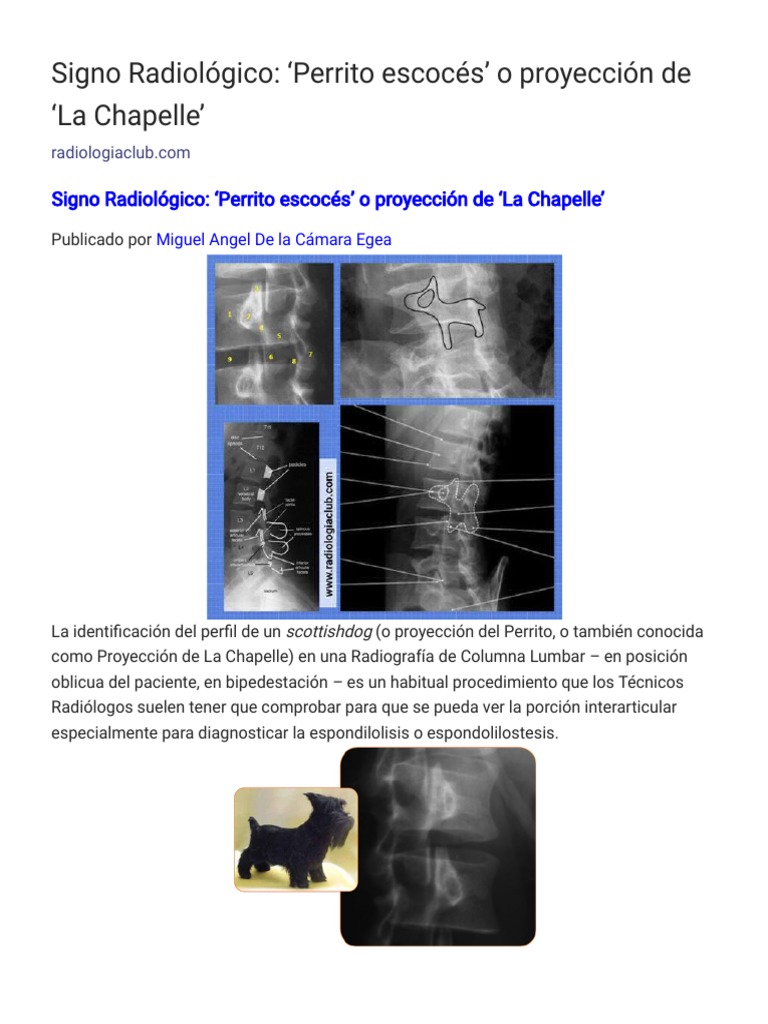 Signo Radiológico - Perrito Escocés' o Proyección de La Chapelle ...