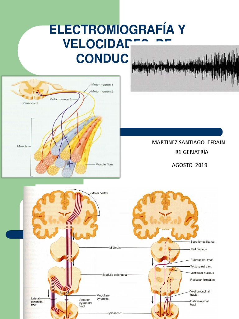 Electromiografia y Velocidades | PDF | Nervio | Electromiografia