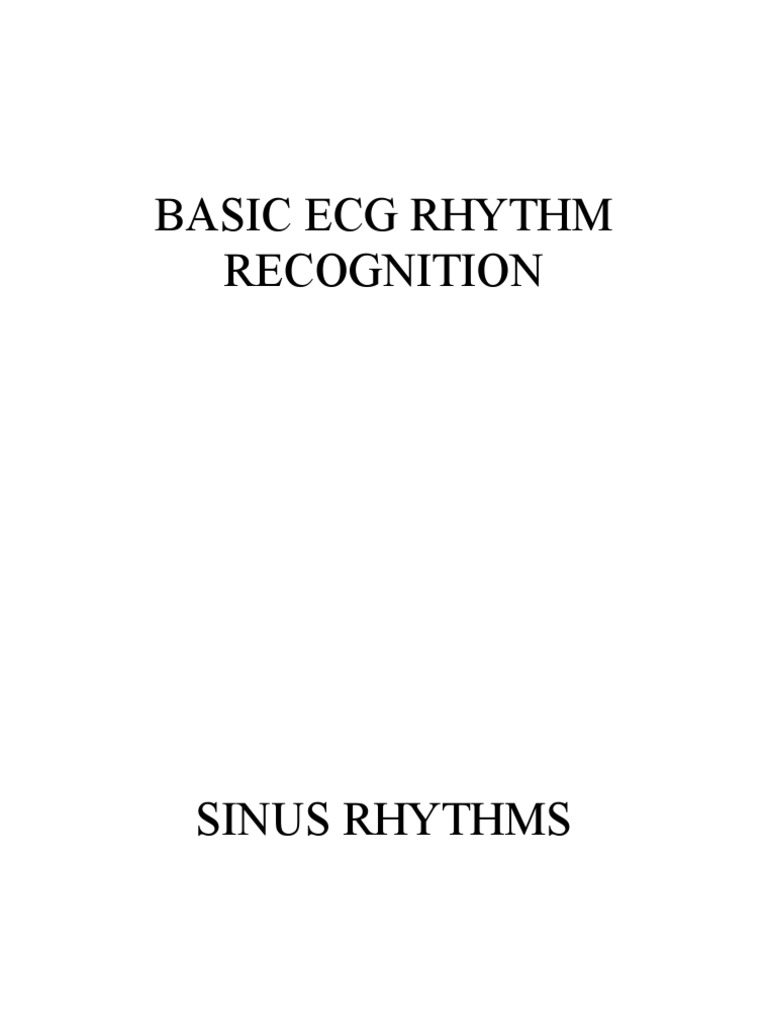 Ecg Rhythm Recognition | PDF