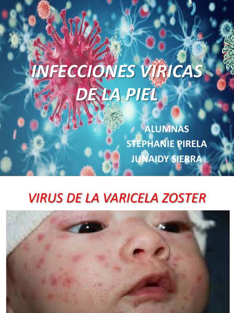 Infecciones Viricas de La Piel | PDF | Herpes Simple | Virus