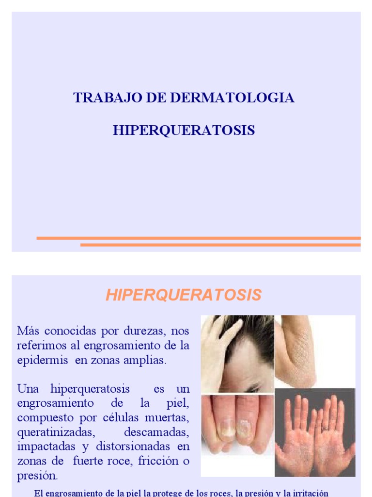 Hiperqueratosis: Causas y Tratamientos | PDF | Sistema tegumentario ...