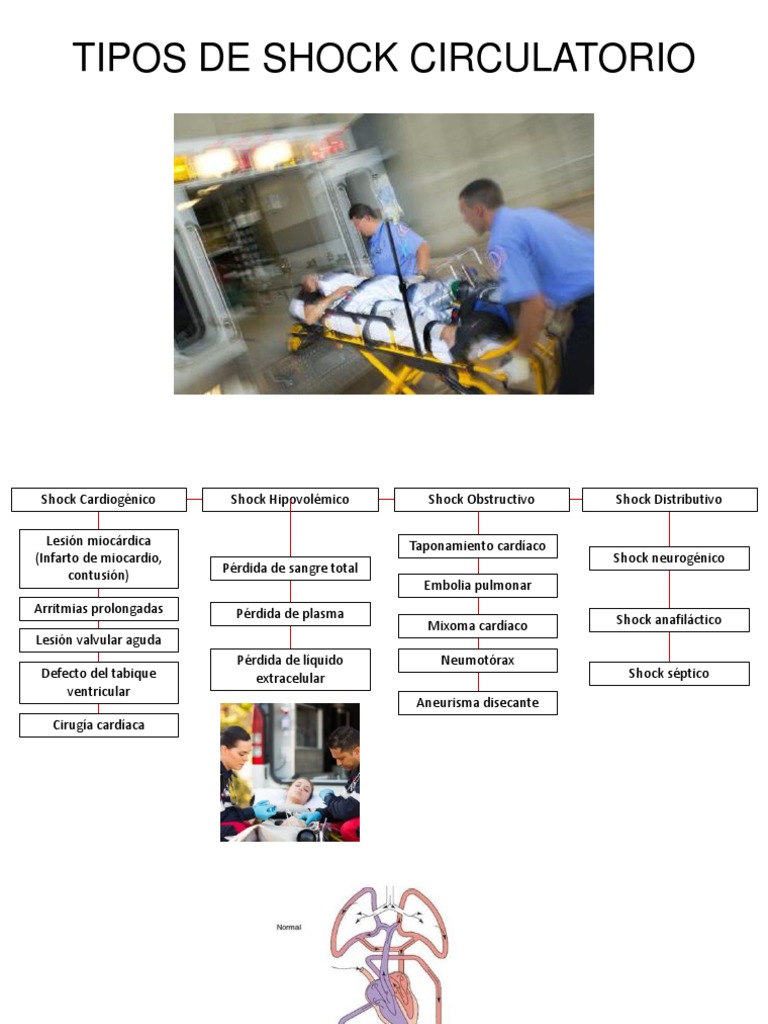 Tipos de Shock Circulatorio y Cardiogénico | PDF
