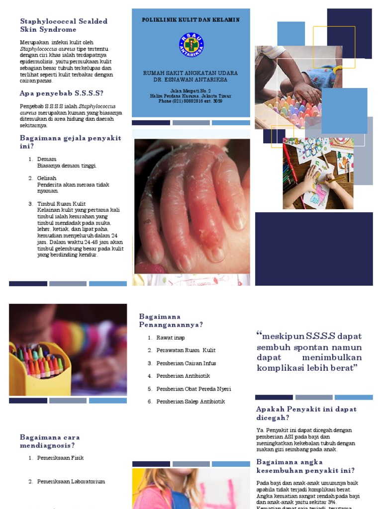 Staphylococcal Scalded Skin Syndrome | PDF