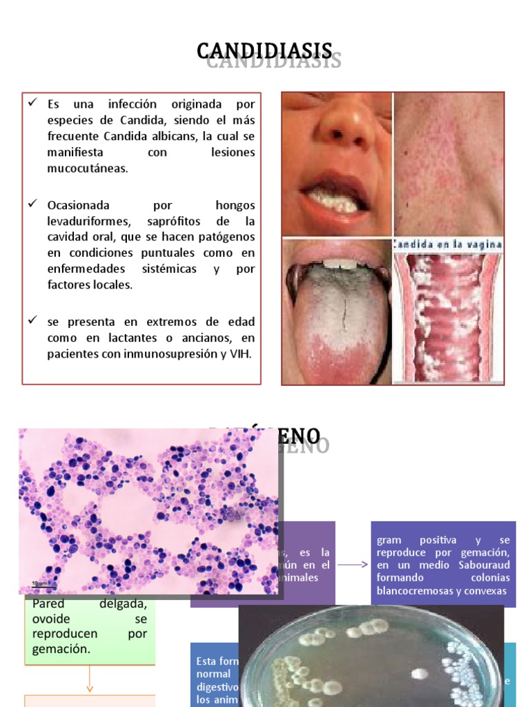 Candidiasis: Infecciones y Tipos | PDF | Candida (hongo) | Candidiasis