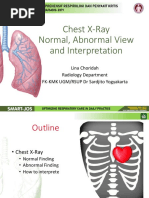 Chest X-Ray Template | PDF | Lung | Thorax
