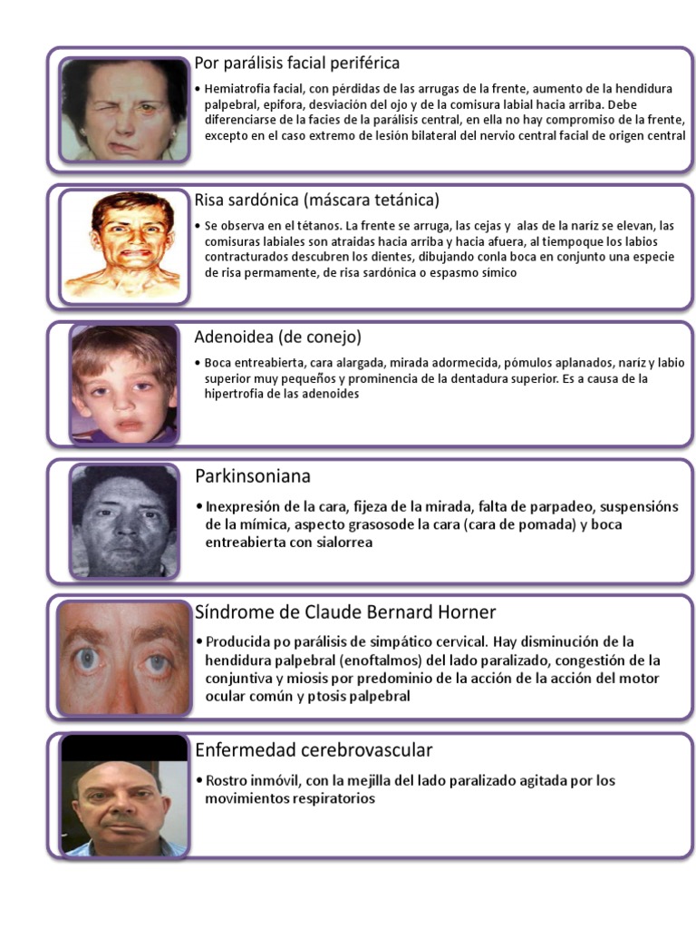 Semiologia - Facies | Download grátis PDF | Enfermedades y trastornos ...