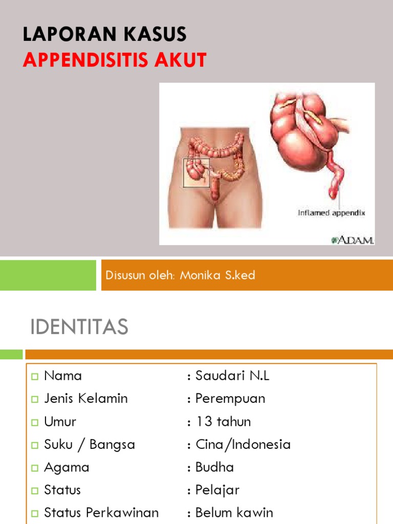 Laporan Kasus Appendisitis Akut | PDF
