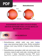 Askep Retinoblastoma Pada Anak | PDF
