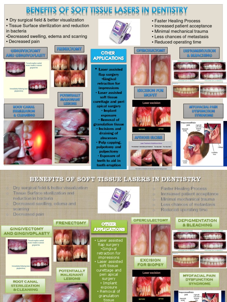 POSTER | PDF | Surgery | Mouth