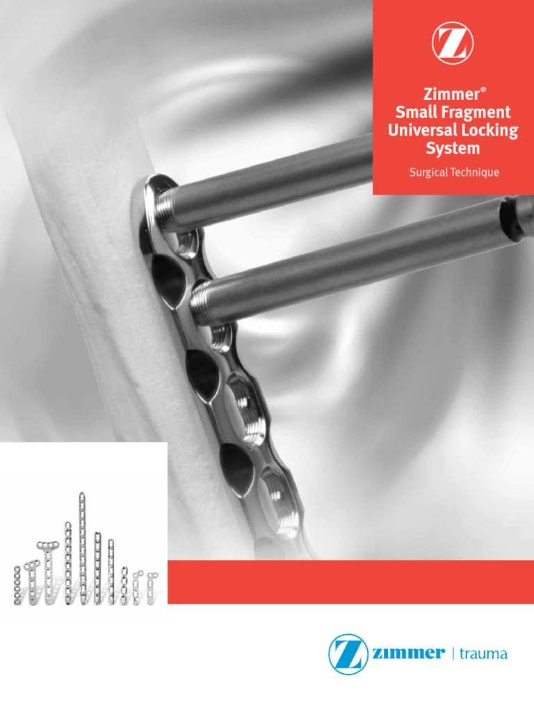 Zimmer Small Fragment Universal Locking System Surgical Technique1 ...