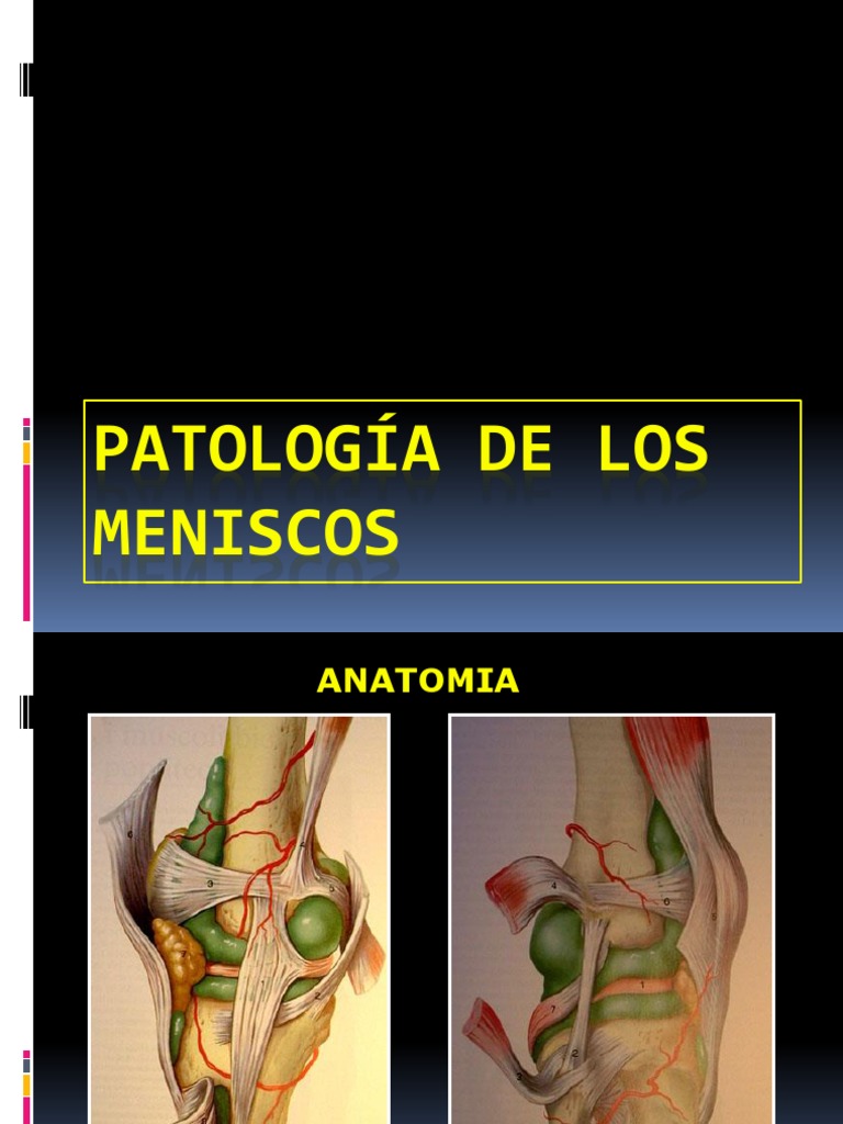 18 Meniscos | PDF | Rodilla | Sistema musculoesquelético