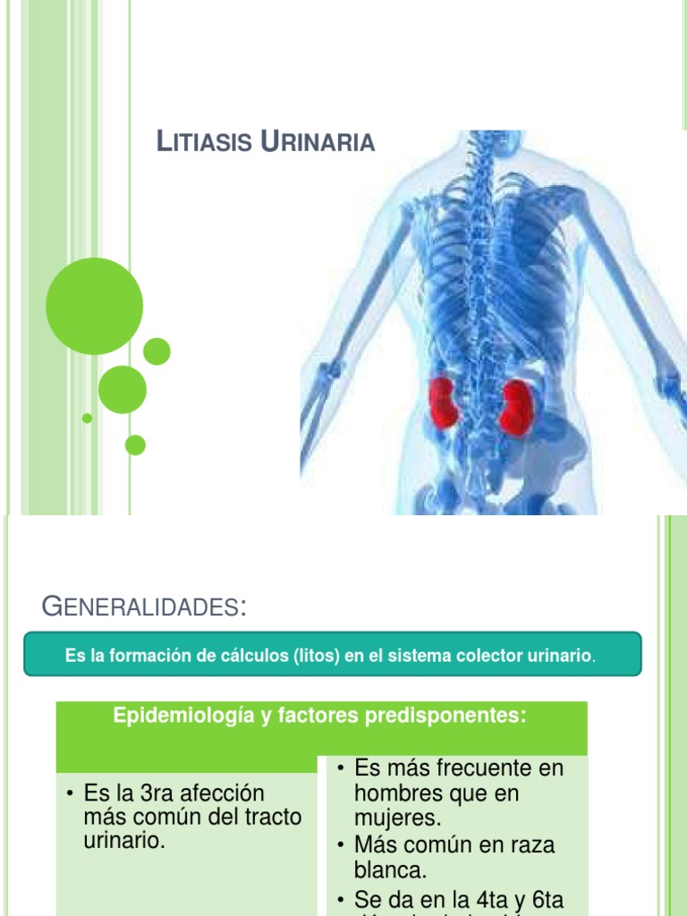Litiasis Renal | PDF | Sistema genitourinario | Especialidades Medicas