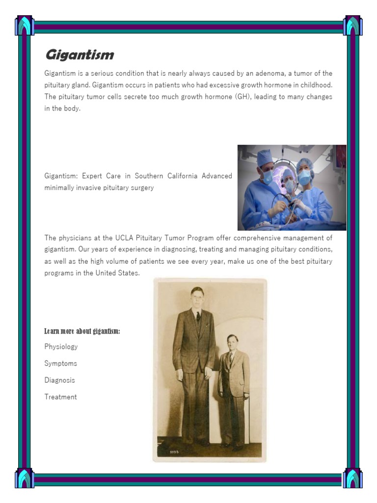 Gigantism (Final) | PDF | Growth Hormone | Endocrine System