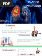 Tumores de Cavum | PDF | Cáncer | Cabeza y cuello humanos