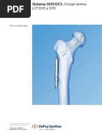 Endobutton CL Ultra TECNICA v2 | PDF | Extremidades (anatomía ...