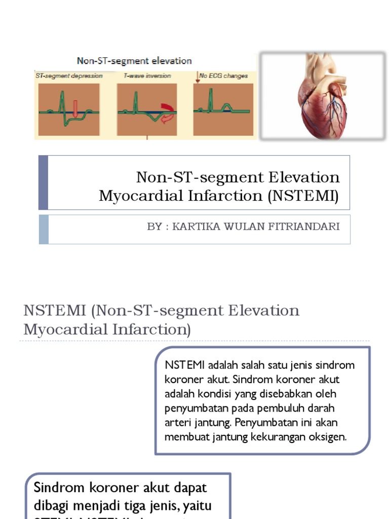Non-ST-segment Elevation Myocardial Infarction (NSTEMI) | PDF