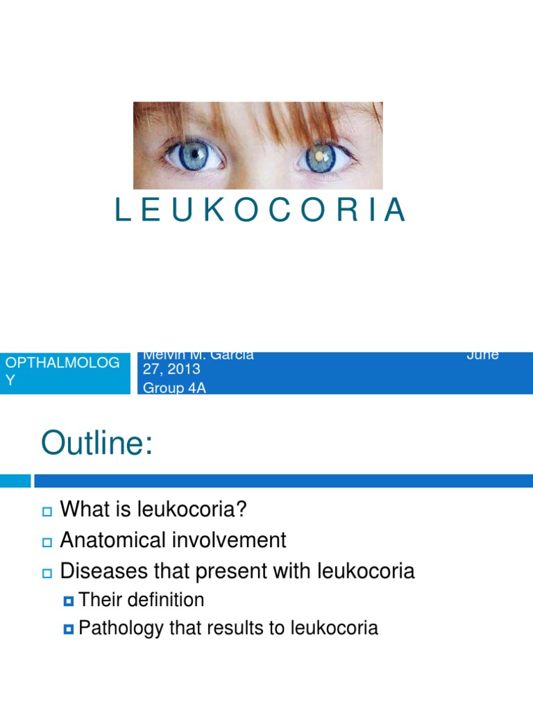 Leukocoria 180720093442 | PDF | Cataract | Eye