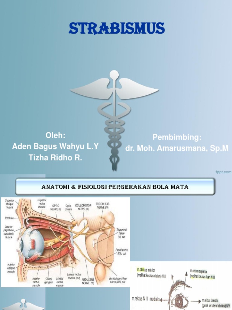 Strabismus PPT Fix | PDF