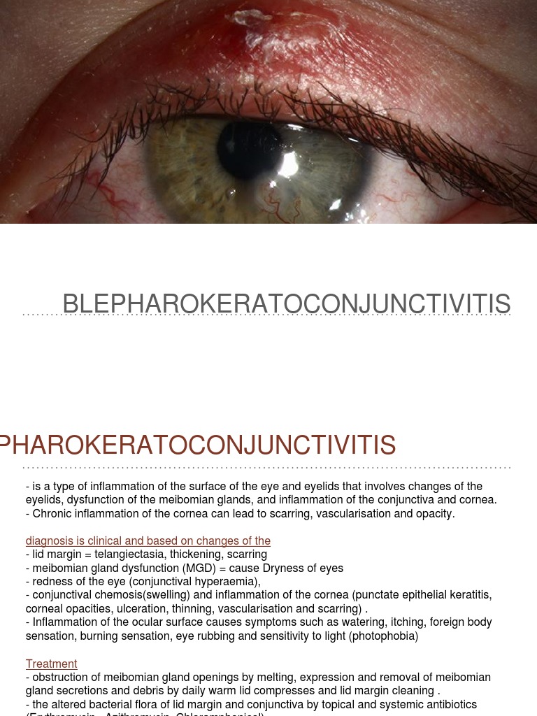 Opthal | PDF | Cornea | Sensory Organs