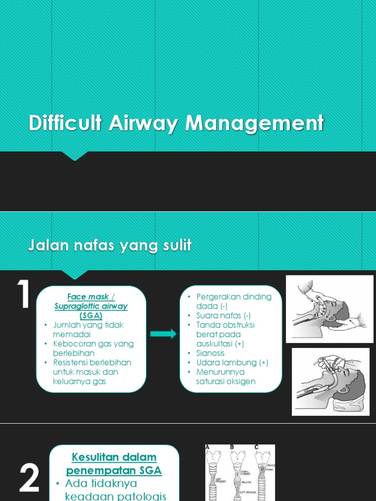 Difficult Airway Management | PDF