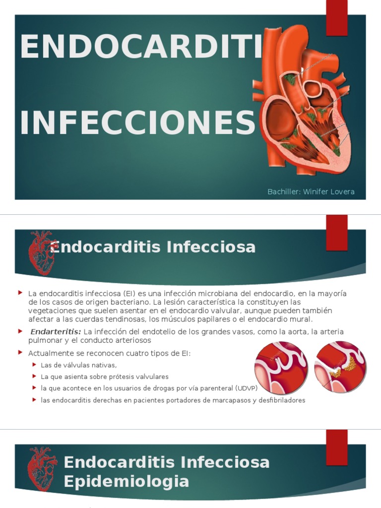 Signos De Endocarditis Infecciosa