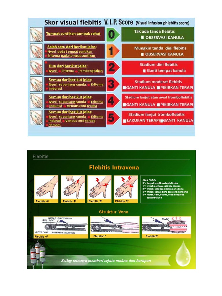 Visual Infusion Phlebitis Score | PDF