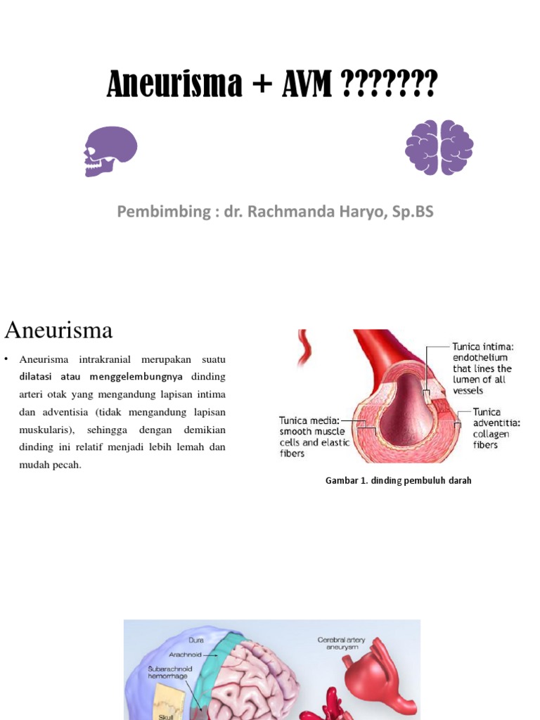 Aneurisma + AVM2-2 | PDF