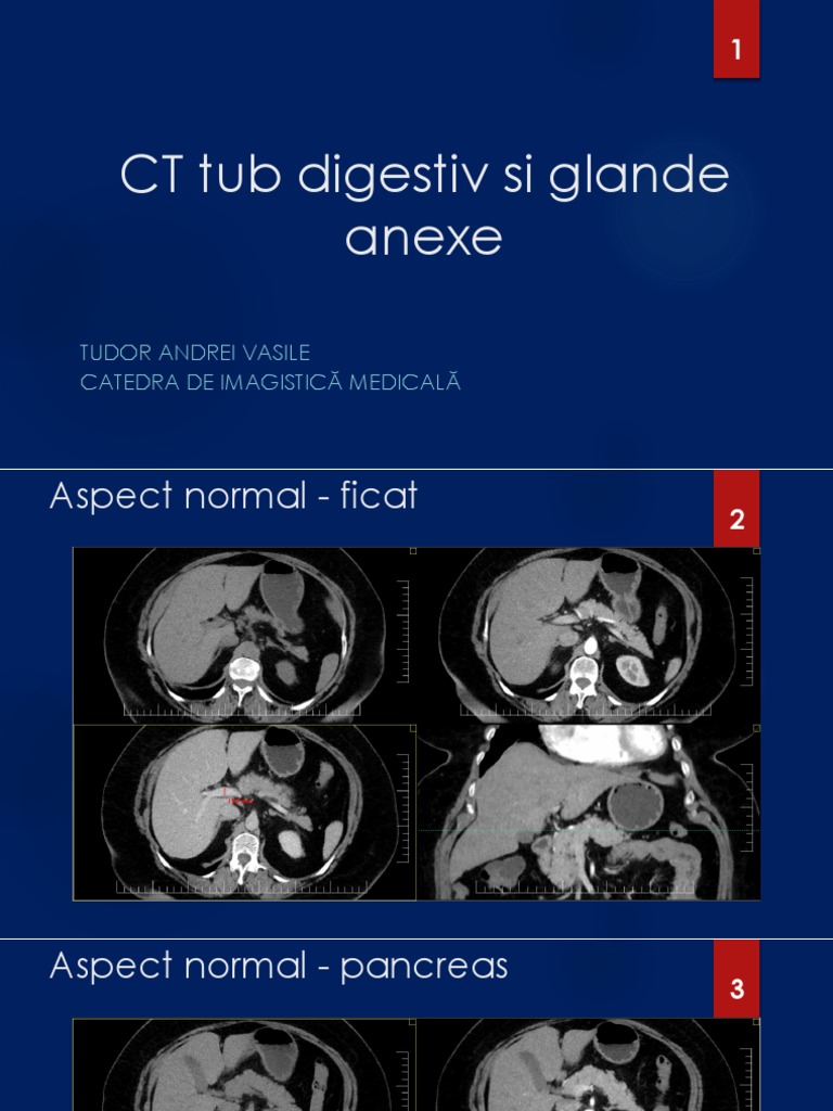 Curs CT | PDF