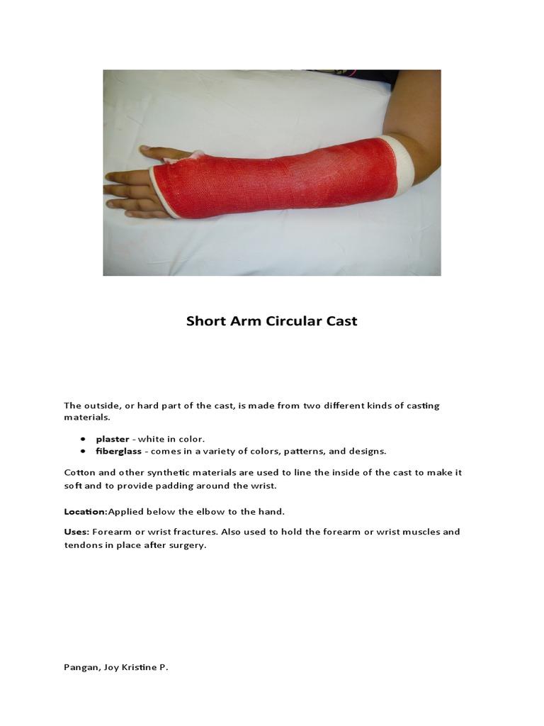 Short Arm Circular Cast | PDF | Hand | Arm