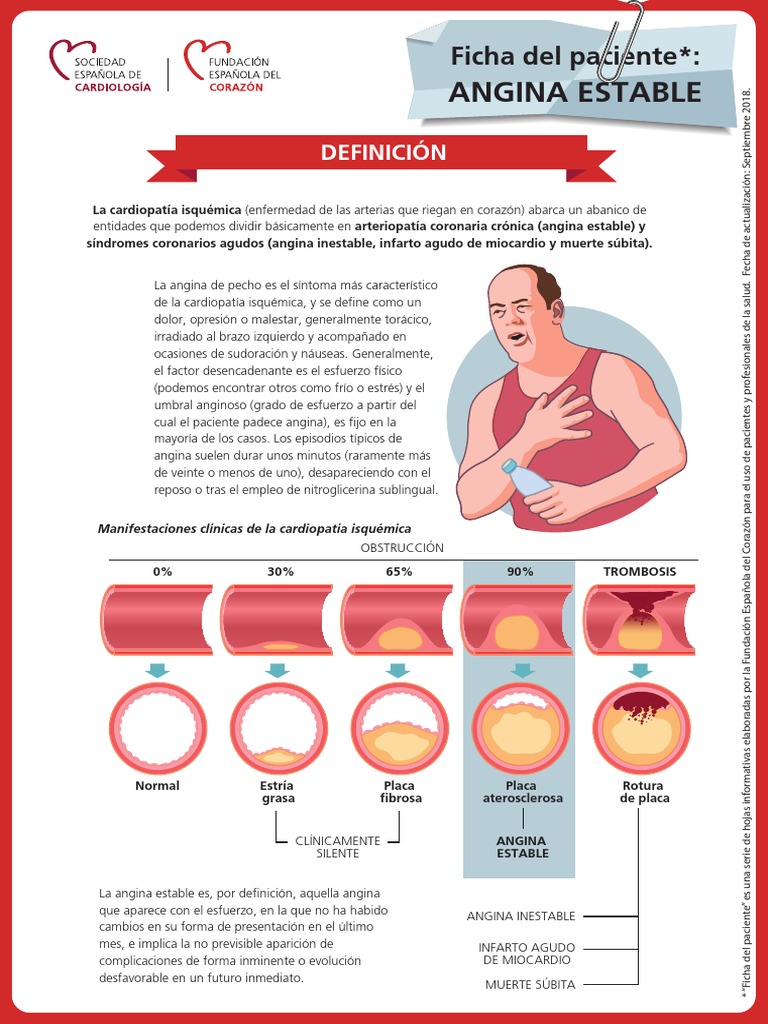 Angina Estable PDF | PDF | Infarto de miocardio | Rtt